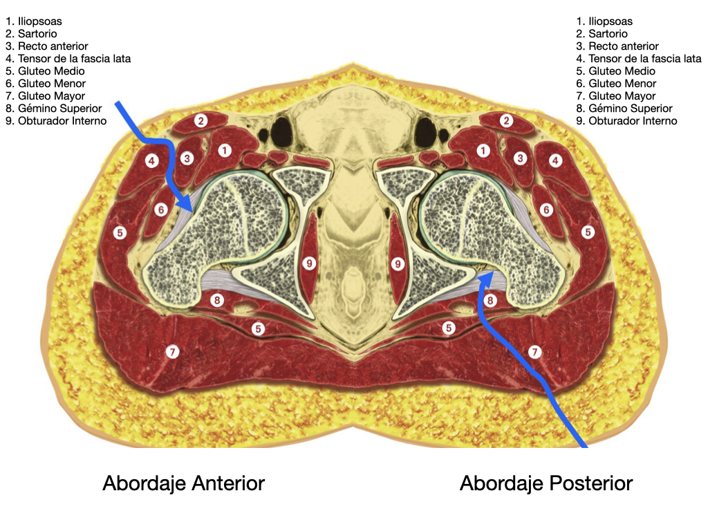 Cirugía Mini-invasiva por Vía Anterior | Dr. Olivetto